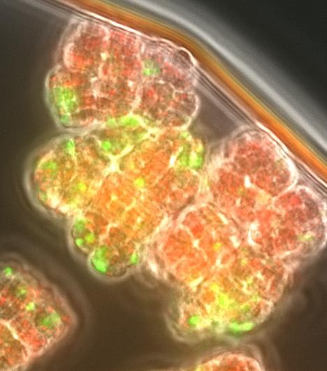 Halococcus morrhuae Zellcluster aus den EVT-Vorversuchen