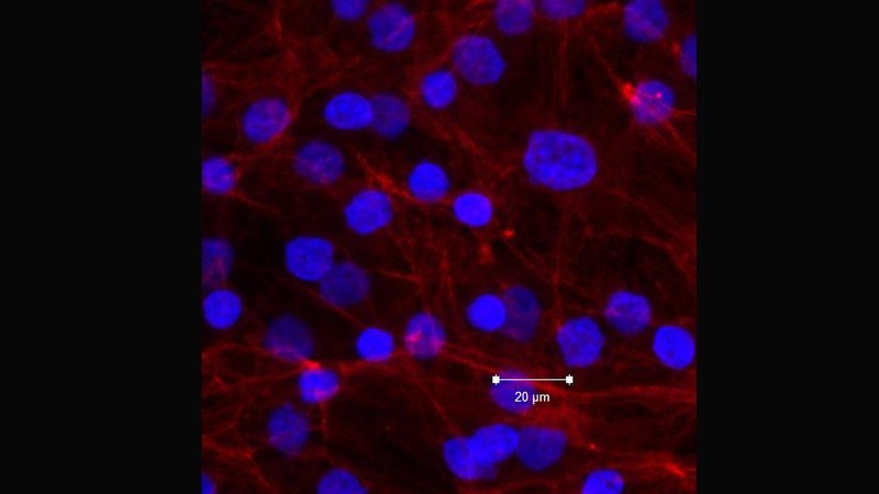 Thyroid cells under the microscope