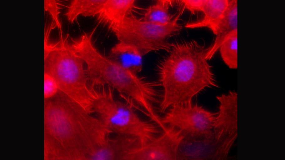 Endothelial cells under the microscope