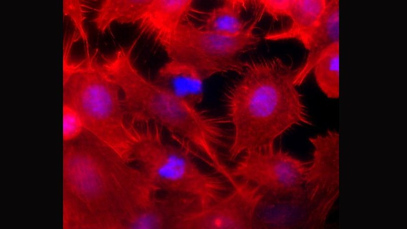 Endothelial cells under the microscope