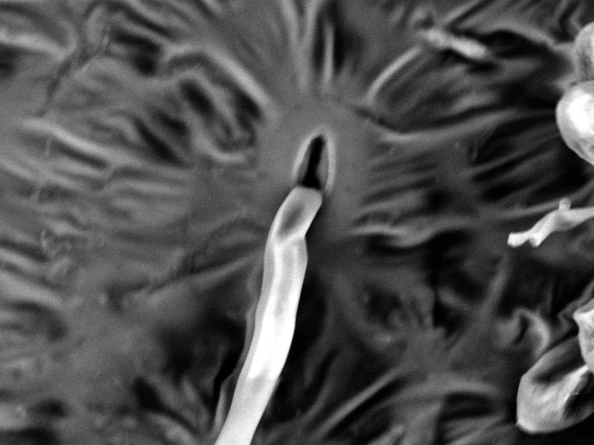 Scanning electron microscope image of a vine leaf affected by downy mildew